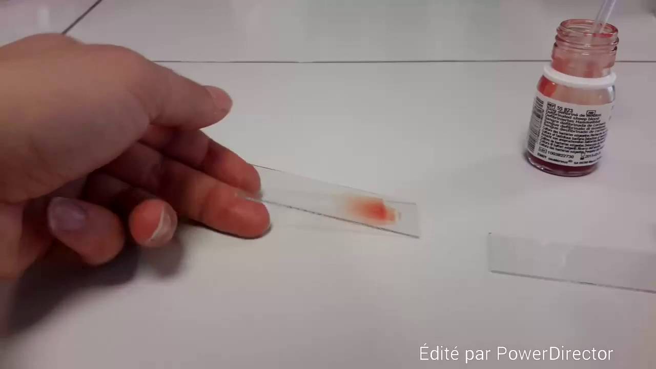 5 Protocole frottis sanguin - YouTube