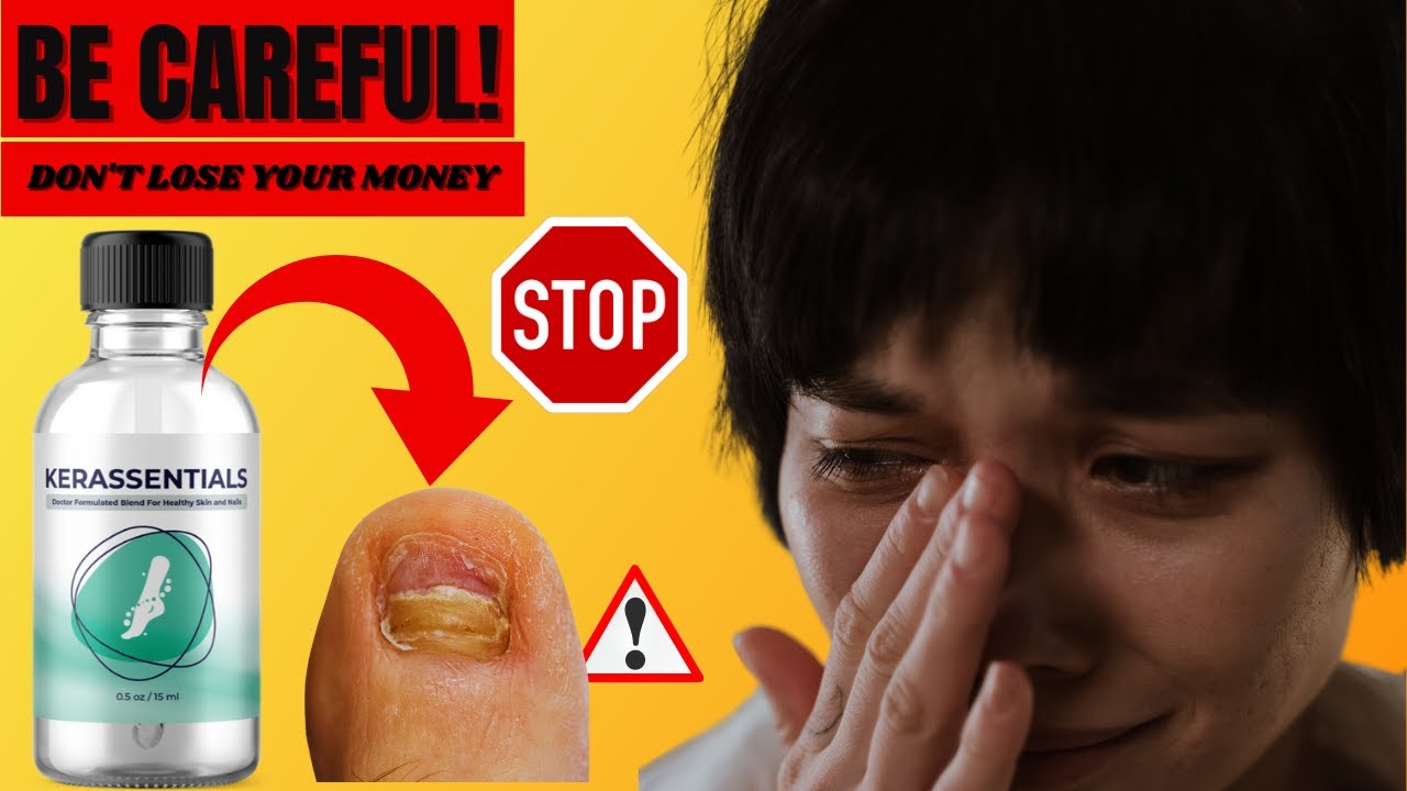 KERASSENTIALS CUSTOMER REVIEW 2023 - Kerassentials Oil Nail Fungus ...