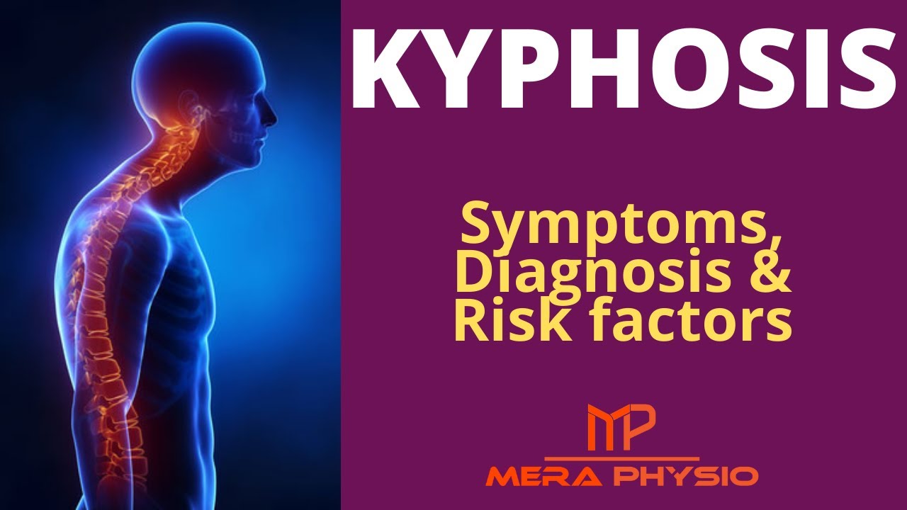 Kyphosis (Hunchback) | Symptoms, Diagnosis, Risk Factors of Kyphosis ...