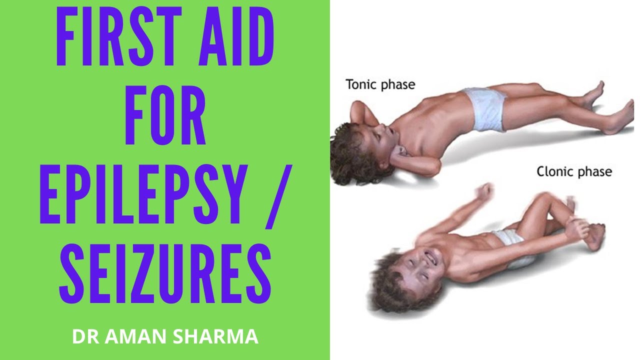 मिर्गी का दौरा - क्या करें | FIRST AID FOR SEIZURES | झटके आने पर क्या ...