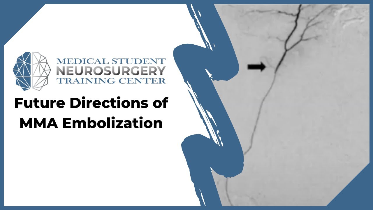 Future Directions of MMA Embolization - YouTube