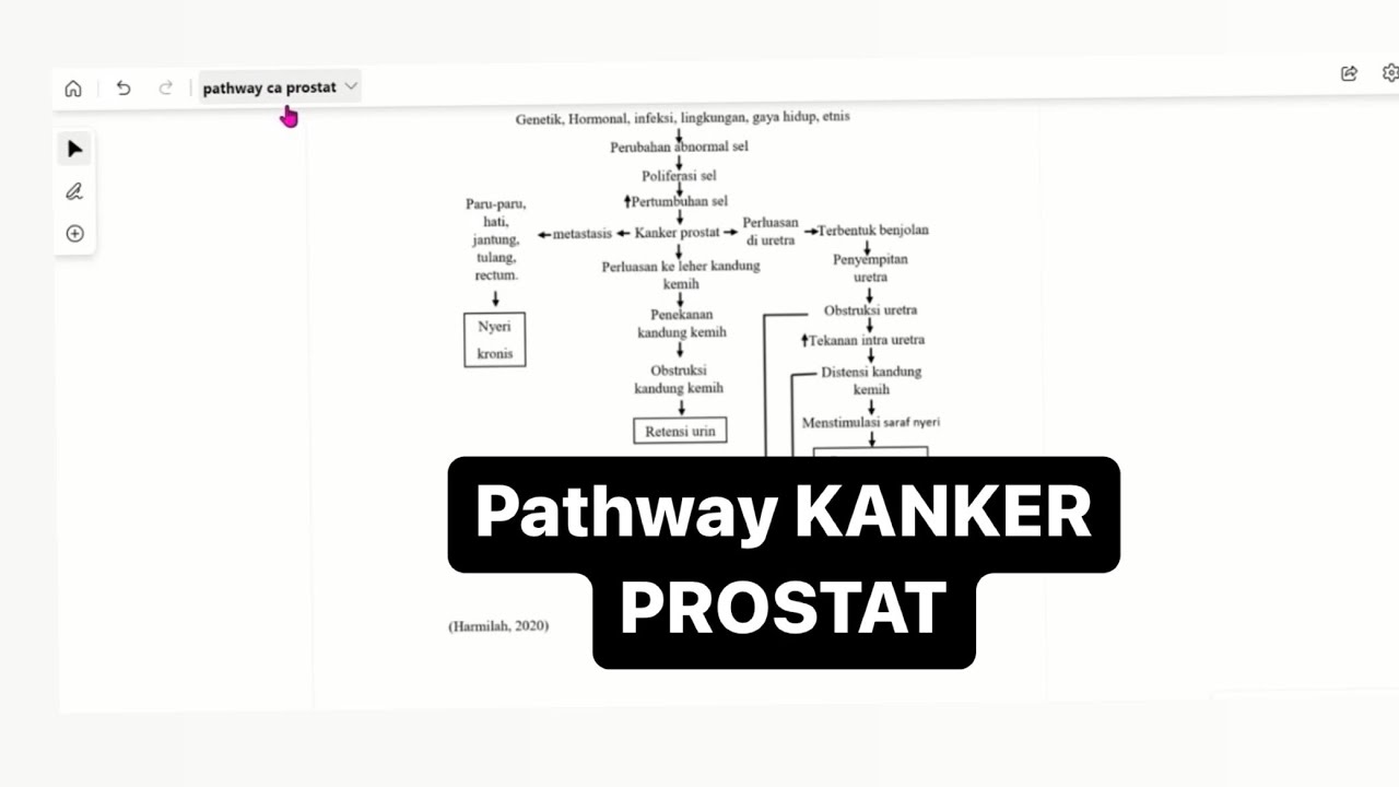 Pathway KANKER PROSTAT | DIAGNOSA KEPERAWATAN eps.11 - YouTube