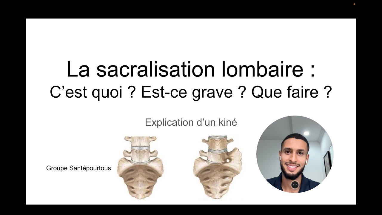 Sacralisation lombaire : Faut-il s'inquiéter ? (lien avec le mal de dos ...