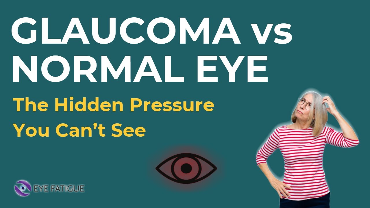 Glaucoma Eye vs Normal Eye: The Hidden Pressure You Can’t See - YouTube