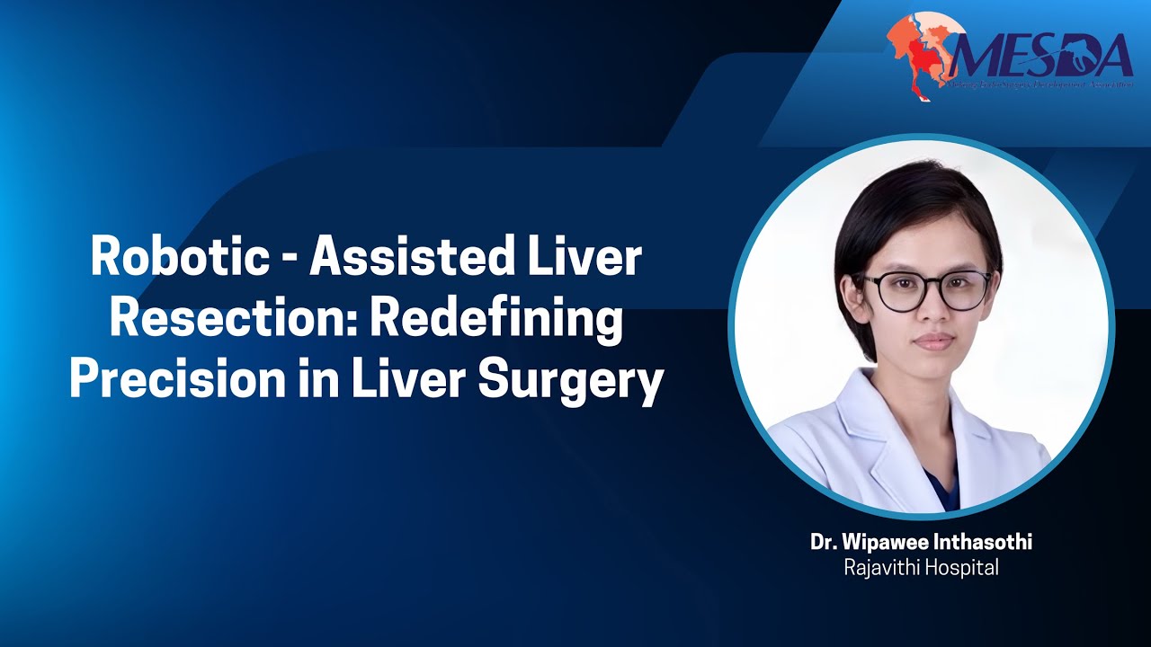 27thMESDA- Robotic - Assisted Liver Resection: Redefining Precision in ...