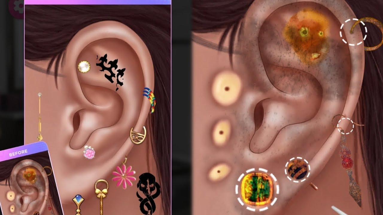 ASMR ANIMATION treatment video | asmr animation ear cleaning @smile bam ...