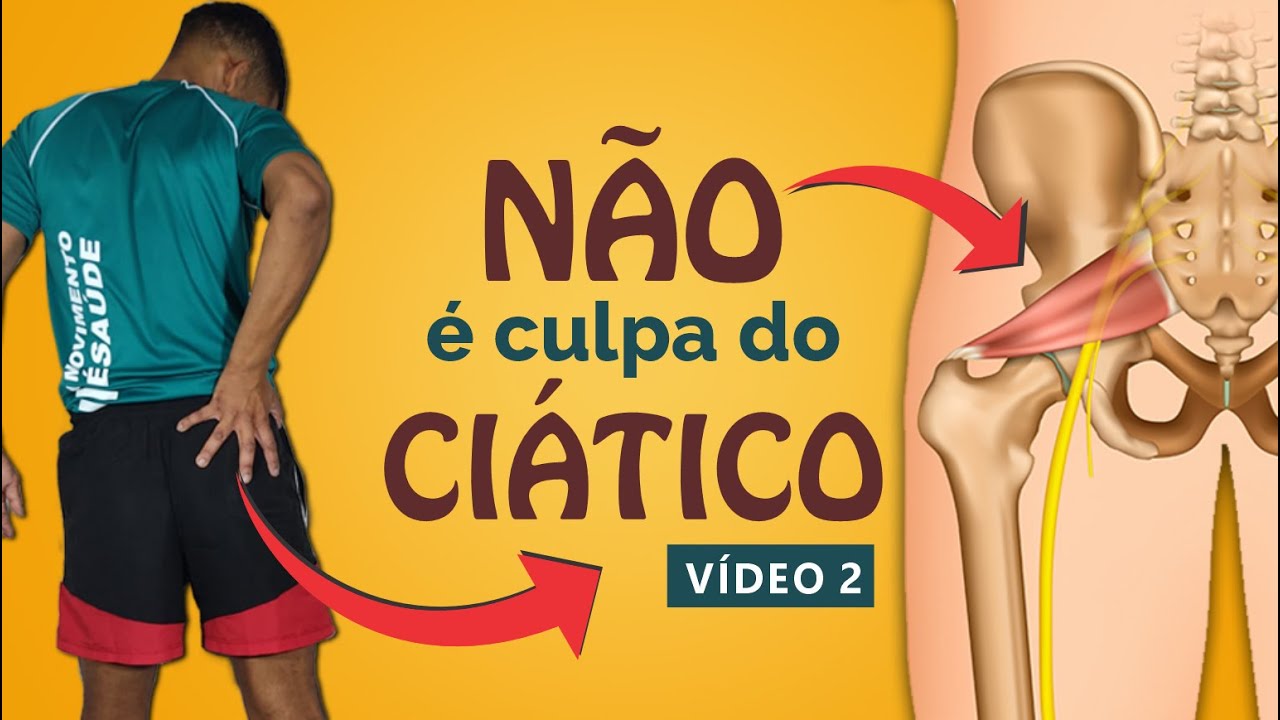 Sua dor nem sempre é o ciático | Síndrome do piriforme | Exercícios ...