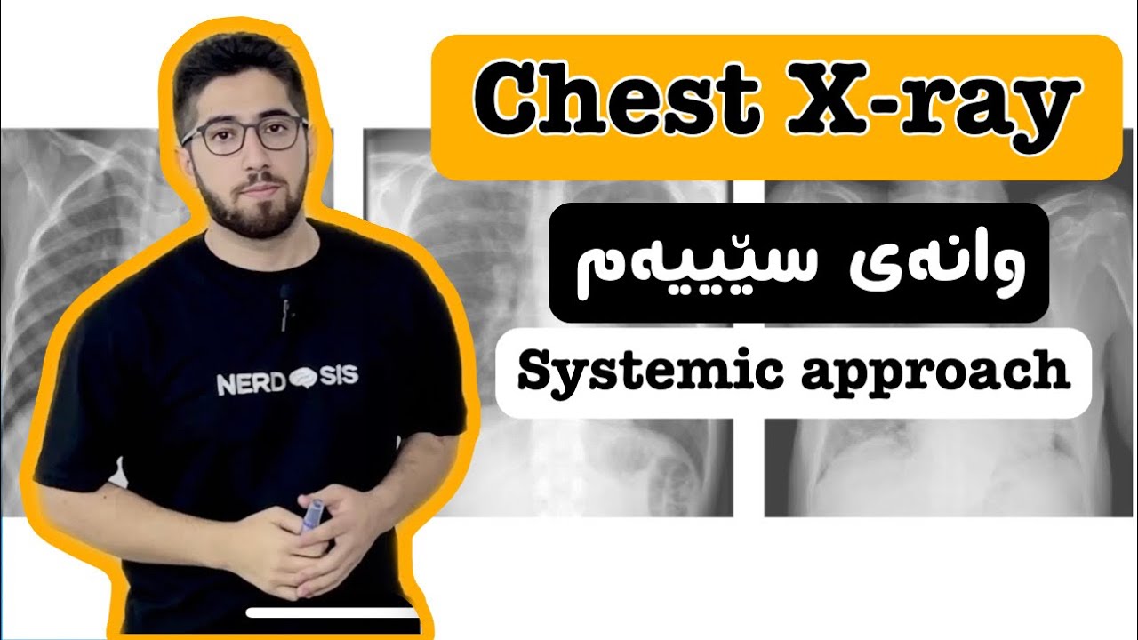 3. Chest X-ray: systemic approach - YouTube