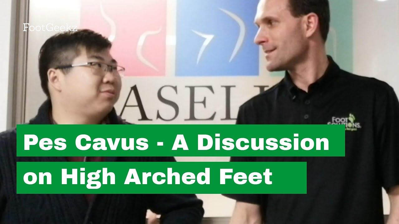 Pes Cavus - A Discussion on High Arched Feet - YouTube