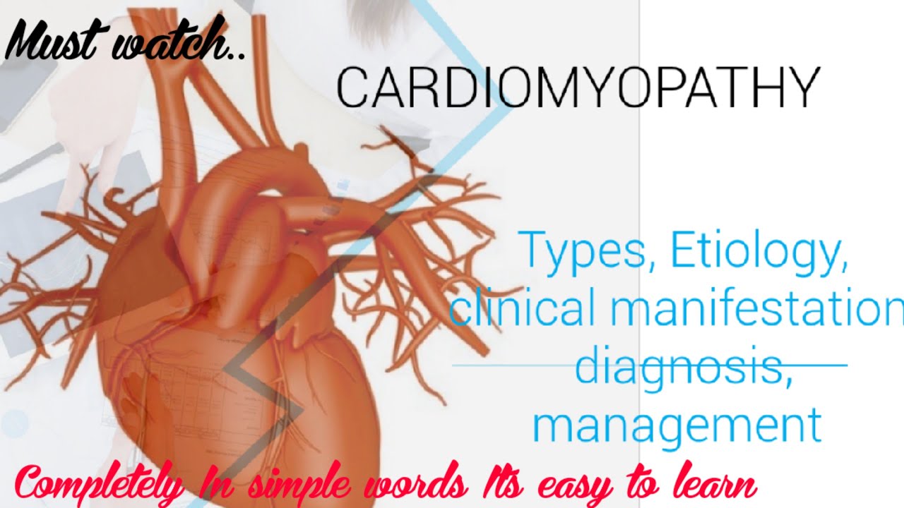 Cardiomyopathy overview for nursing students in easy language || easy ...