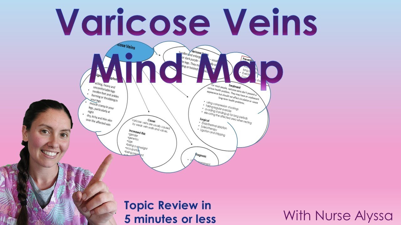 Varicose veins Mind Map - YouTube