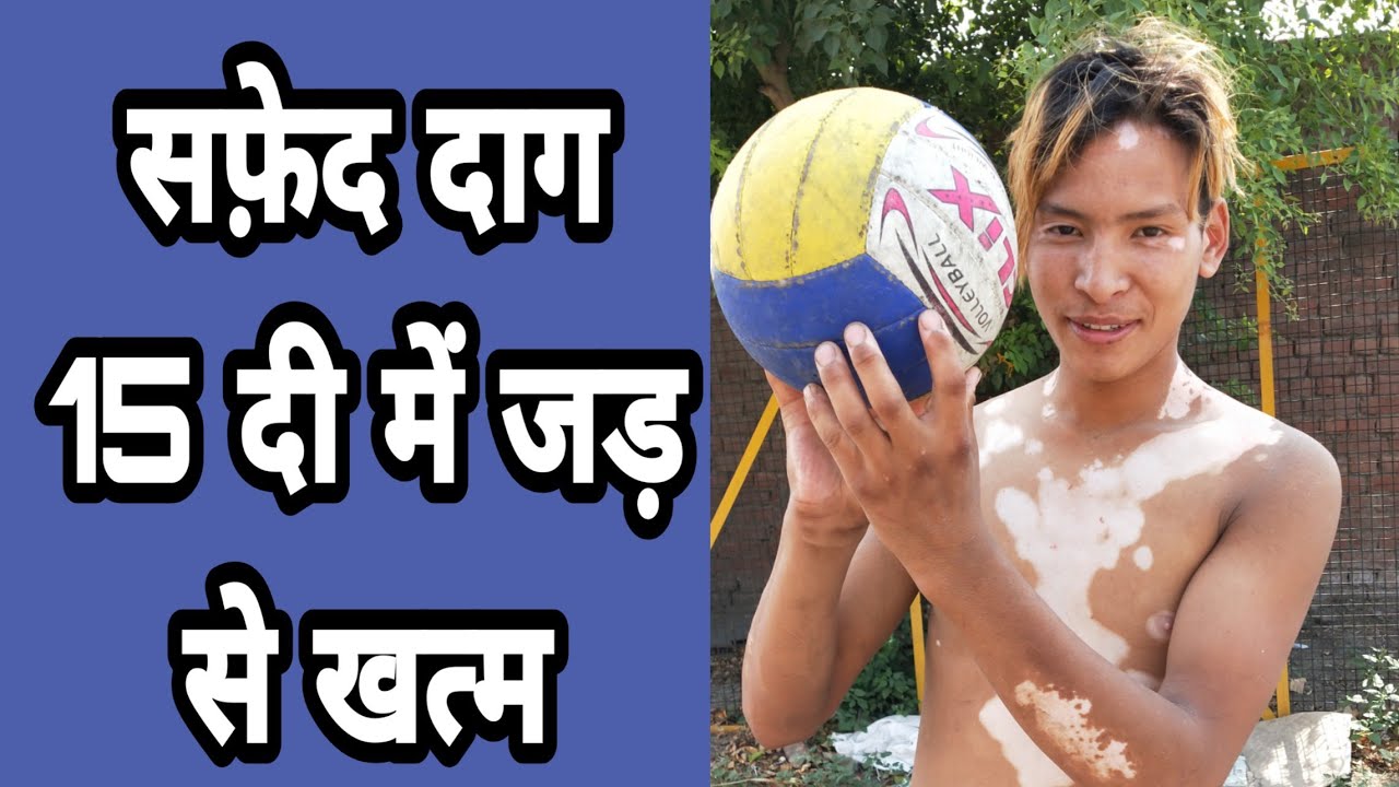 safed daag ka desi ilaj||leucoderm|| - YouTube