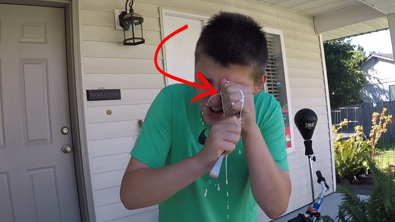 Popped my eyeball! (PRANK) - YouTube