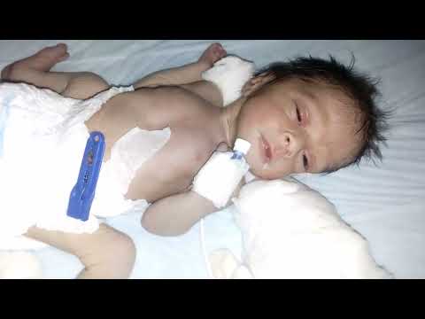 New born baby came with no breath passed ett tube i tried my best but ...