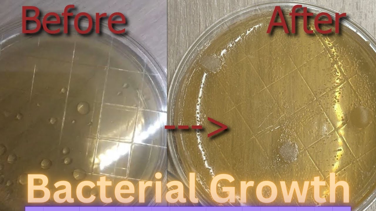 Bacterial Growth (Time Lapse): Faucet Handle Experiment - YouTube