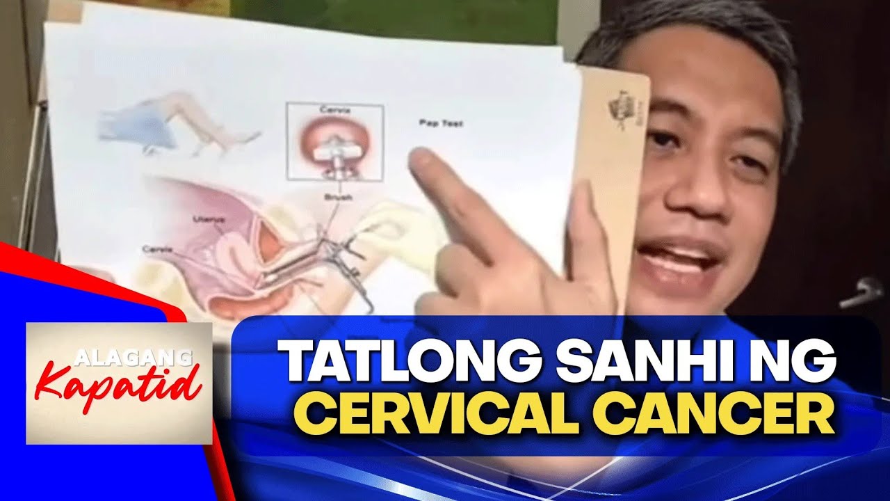 Tatlong sanhi ng cervical cancer sa Pilipinas - YouTube