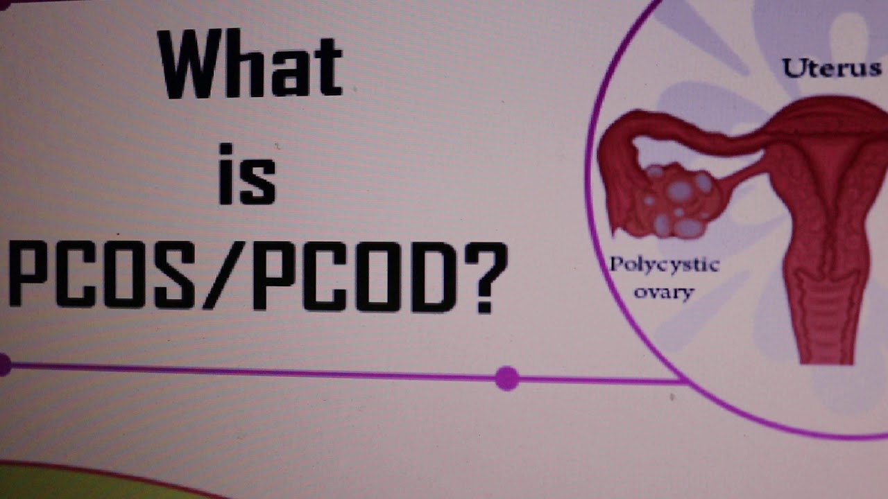 PCOD BY MEDICAL DOCTOR - YouTube