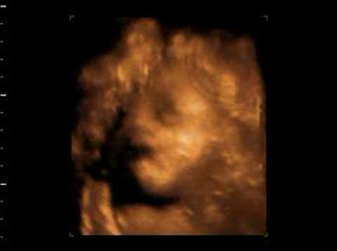 1st 3D/4D Sonogram Clip - YouTube
