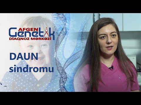 Daun sindromu nədir? Daun sindromuna görə profilaktik müayinənin (skrininqin) növləri.