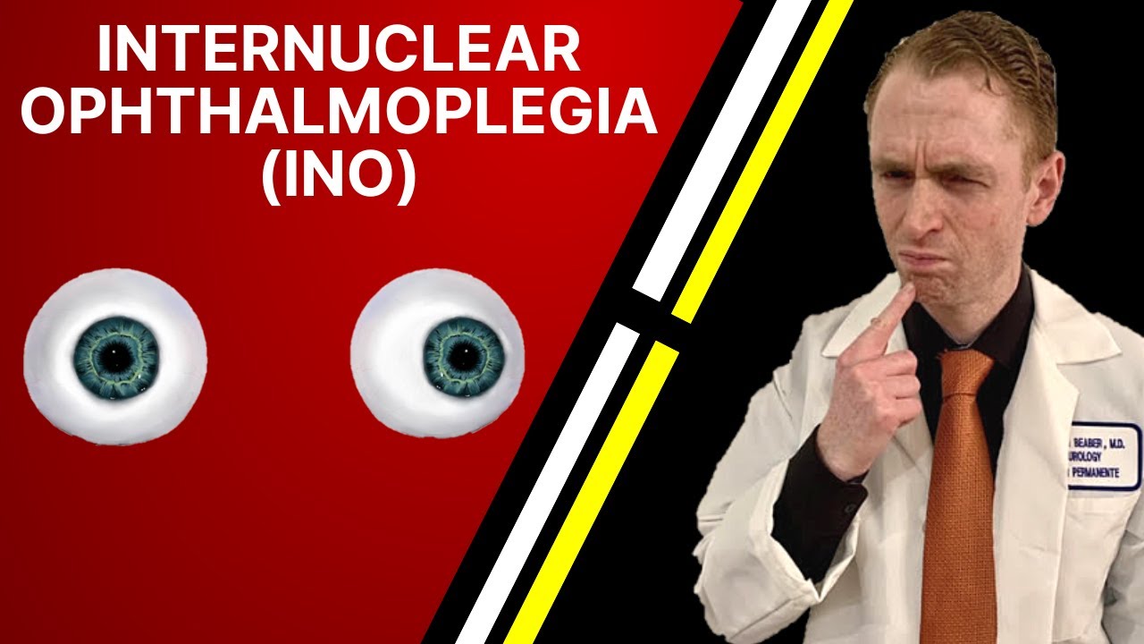 Internuclear Ophthalmoplegia Mri