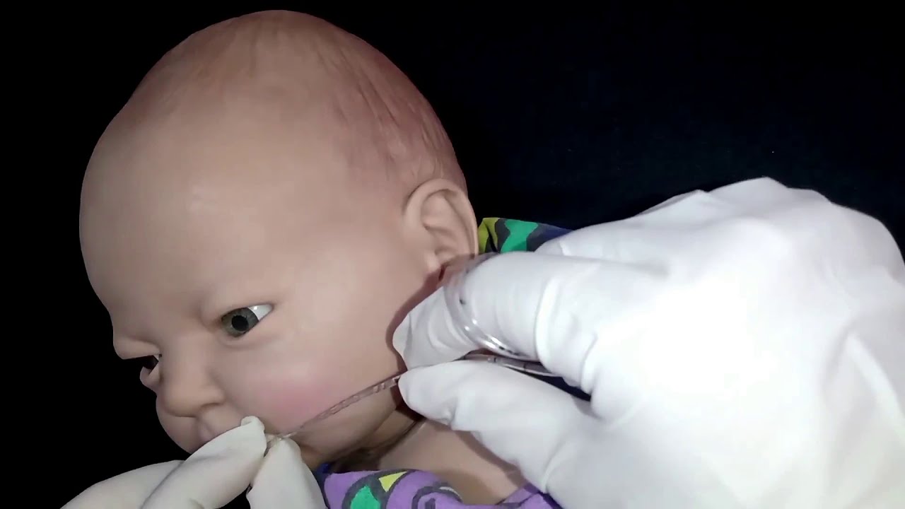 INSTALACIÓN DE SONDA NASOGÁSTRICA Y OROGÁSTRICA EN EL PACIENTE ...