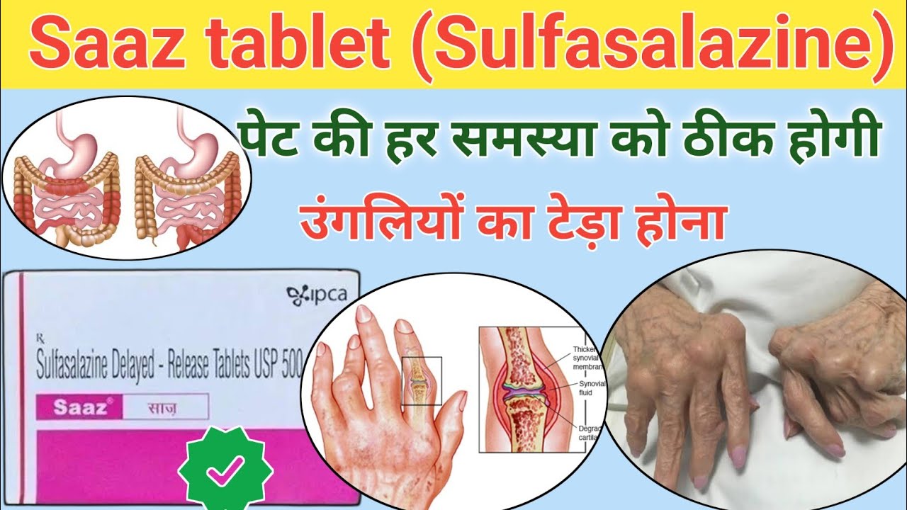 saaz tablet side effects || sulfasalazine delayed release tablets usp ...