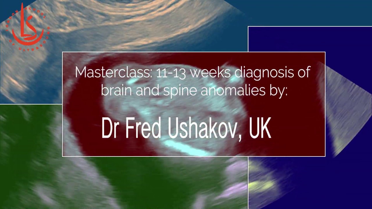 Early Fetal Neurosonography: Diagnosis of fetal brain anomalies at 11 ...