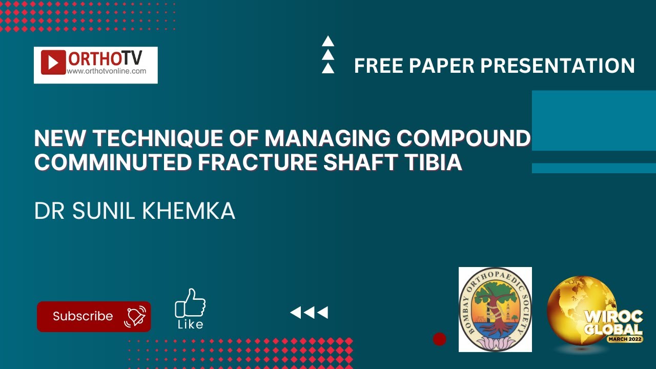 New technique of managing compound comminuted fracture shaft tibia: Dr ...