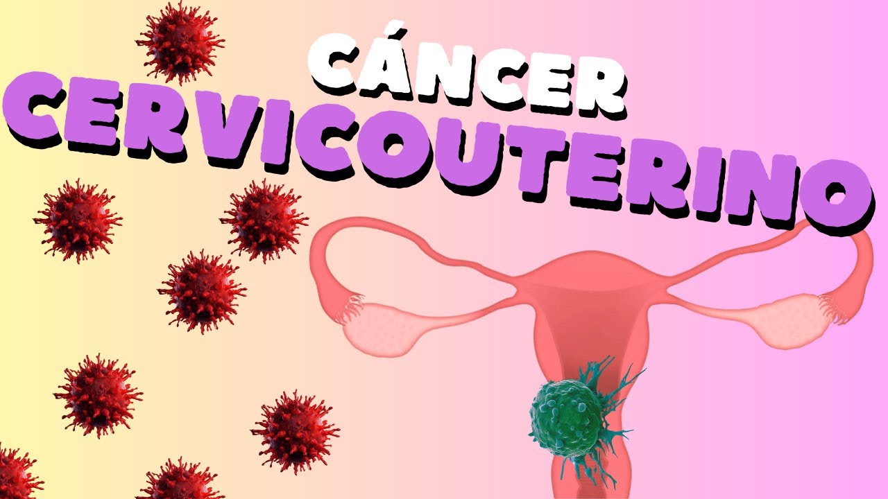 ¿qué Es El Cáncer Cervicouterino Youtube