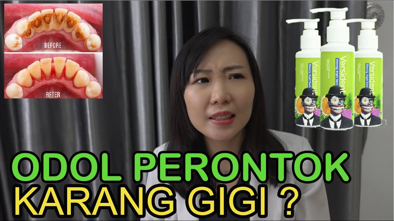 KATA DOKTER GIGI SOAL VERSIDENT SHINING BRIGHT TEETH - YouTube