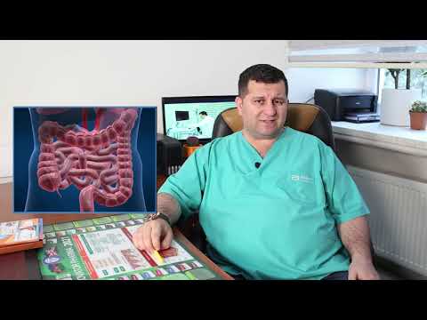 Dr. İlqar Alışov - Ağız qoxusu ( Halitoz )