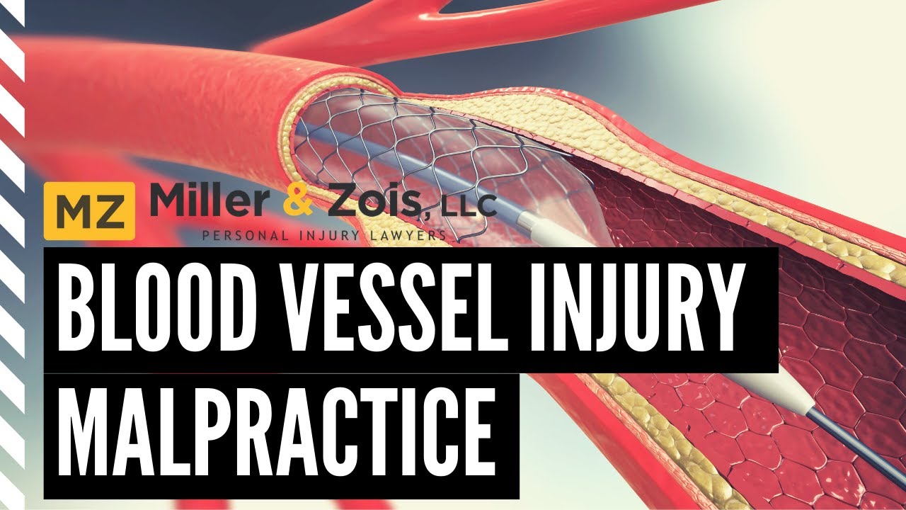 Blood Vessel Injury Malpractice - YouTube