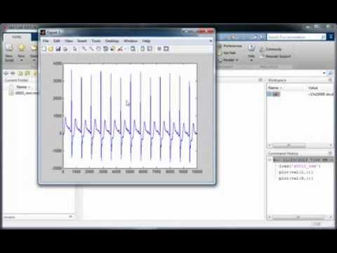 Video1-(ECG Signal) Where could you find and how can load that in ...