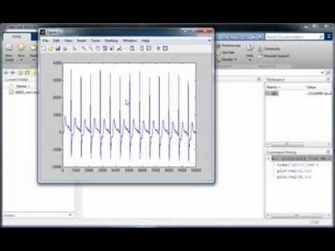 Video1-(ECG Signal) Where could you find and how can load that in ...