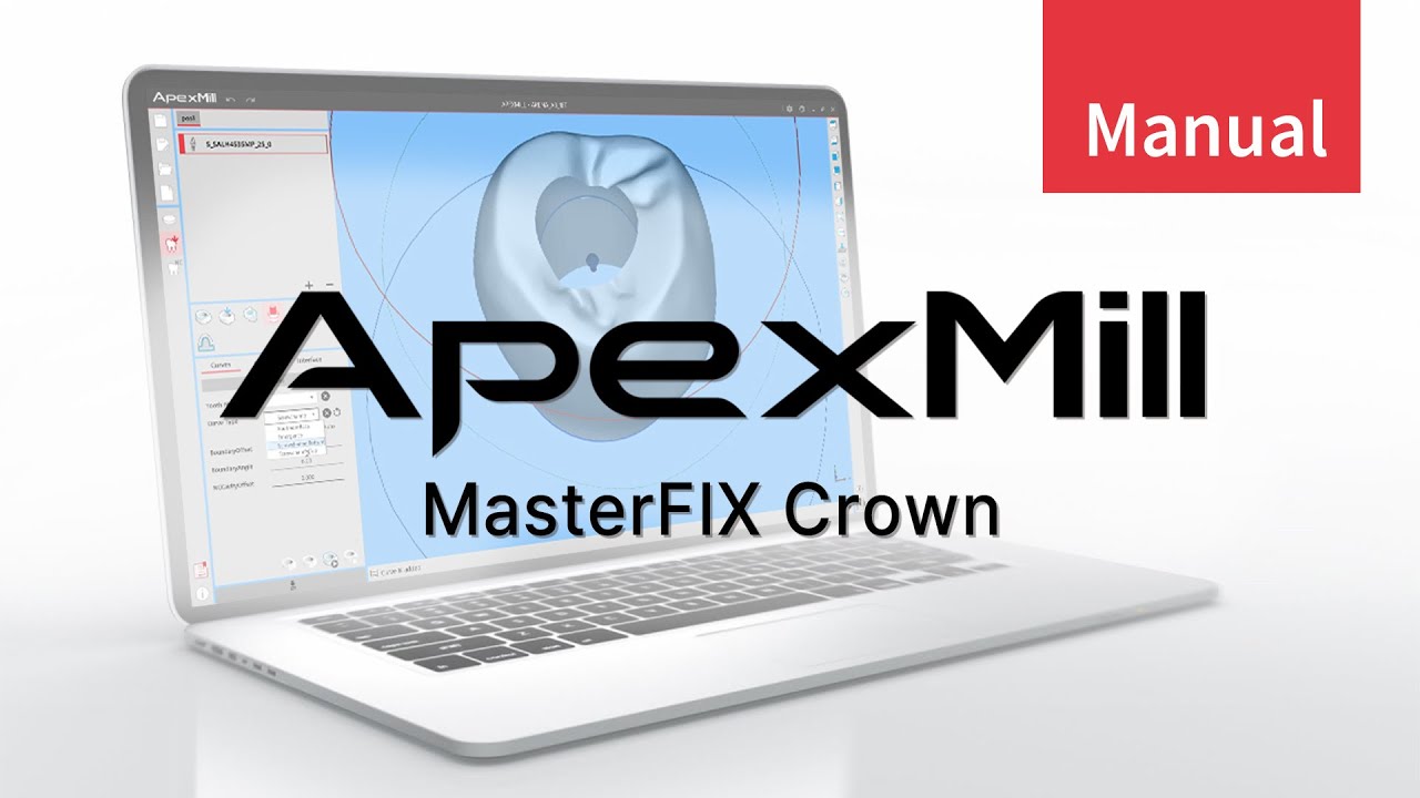 ApexMill_MasterFIX Crown (EN) - YouTube