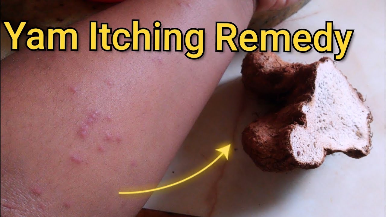 How To Get Rid Of Yam Itching Immediately - YouTube