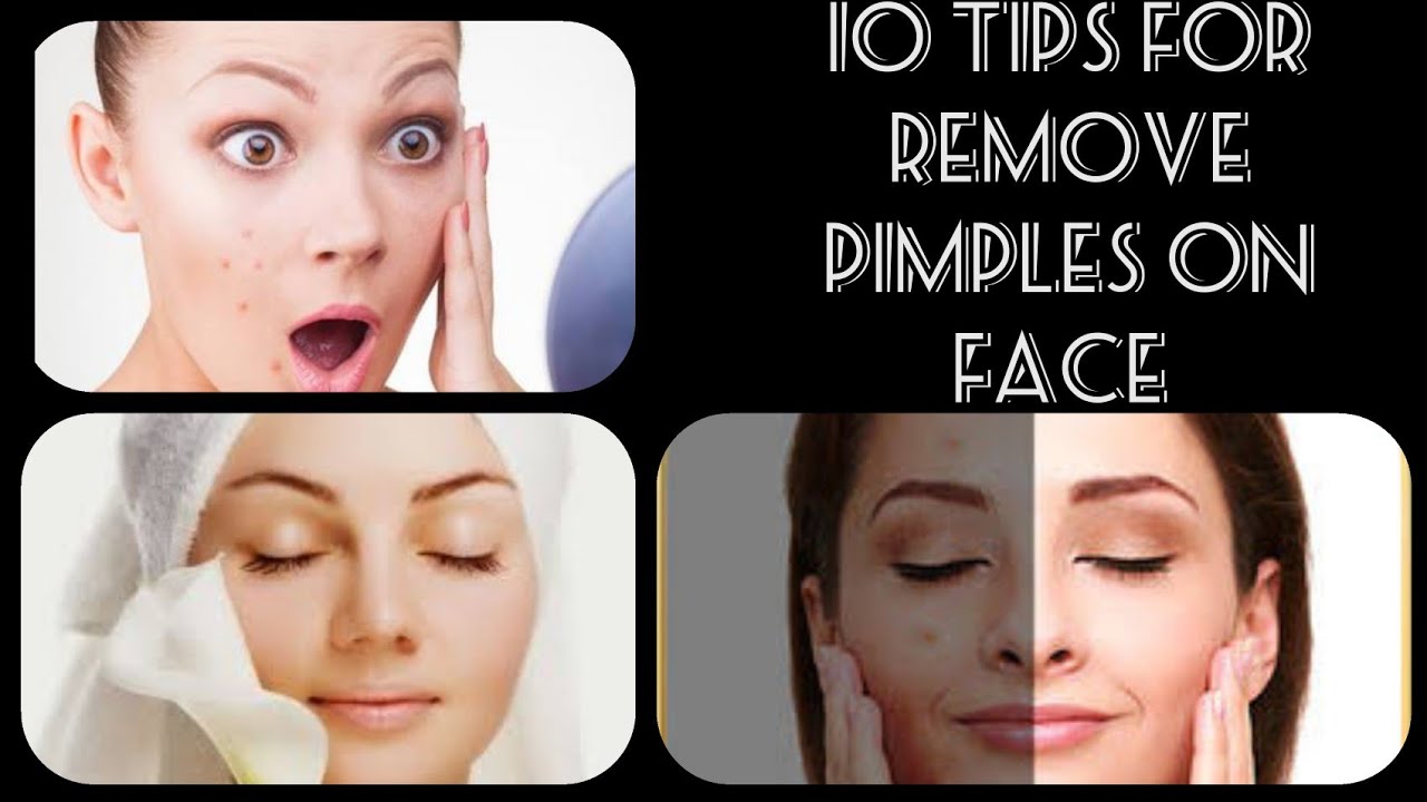 10 tips for remove pimples on face - simple and natural ways to avoid ...