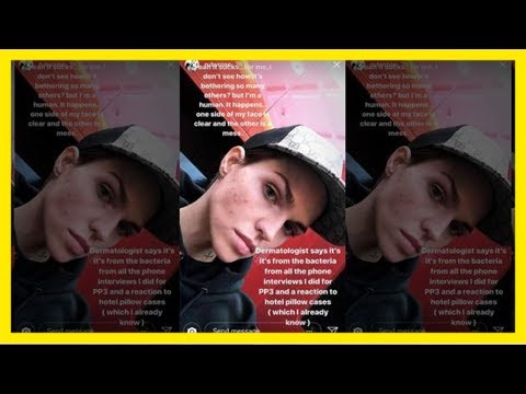 Ruby rose addresses concern over her weight, details struggle with ...