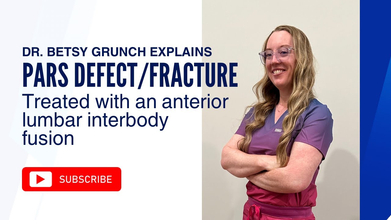 Case study 76- Dr. Grunch EXPLAINS Pars defect/fracture treated by ...