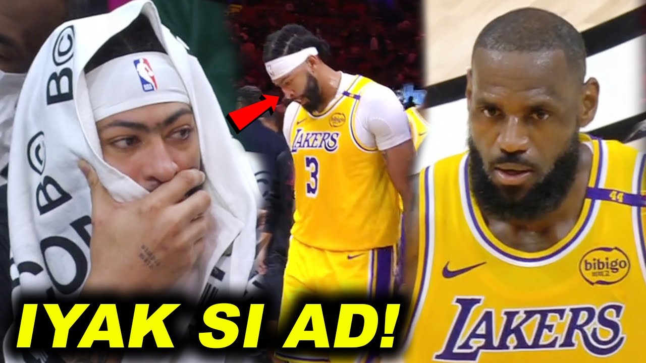 Halos maiyak si Anthony sa nangyare sa Lakers! laking problema nito ...