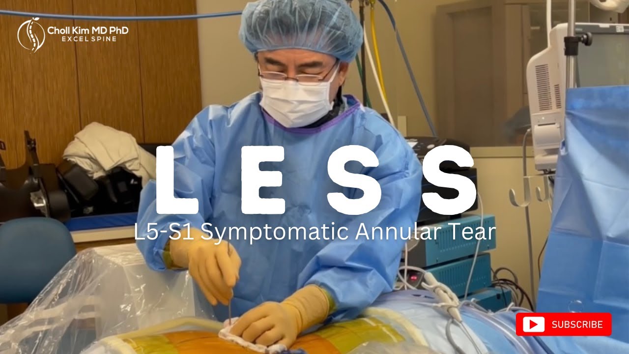 L5-S1 LESS: Back Pain, Leg Pain, & PGAD Symptoms - YouTube