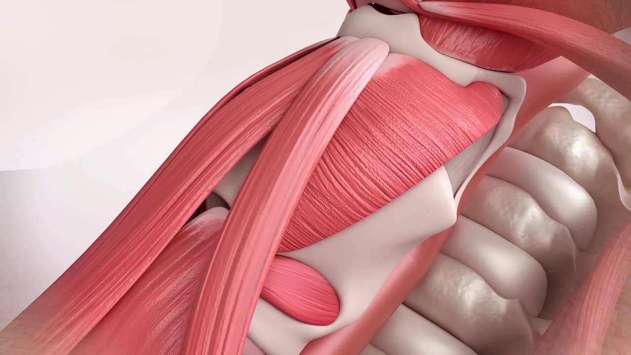 APrevent® VOIS_Standardized type I thyroplasty - YouTube