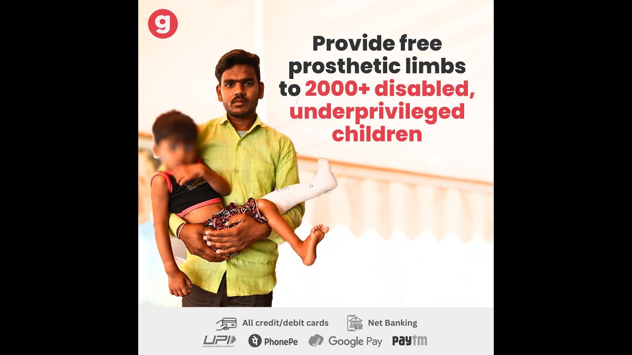 Provide free prosthetic limbs to 2000 underprivileged people and help ...