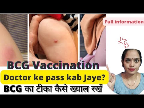 Janam ka tika I First vaccination of baby after birth I BCG ke tike ki detail @epicmomindia