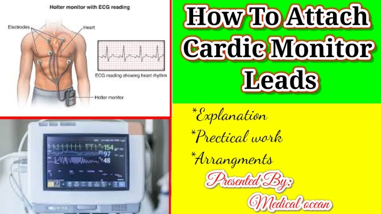 How to attach Cardiac monitor to the patient in urdu Hindi - YouTube
