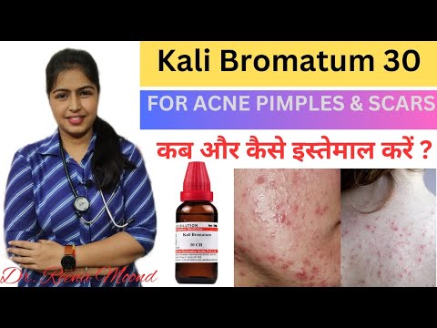 Magical Remedy for acne, pimples & scars | Kali Brom 30 | कब और कैसे ...