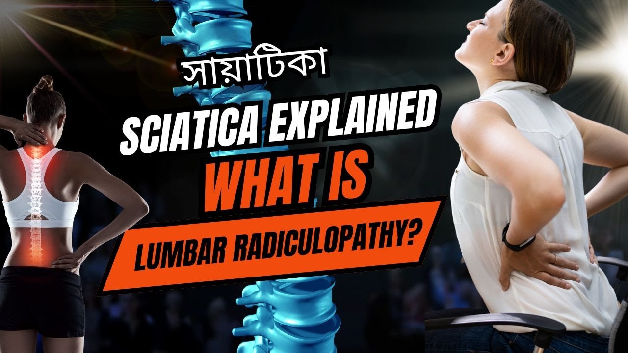 Sciatica Explained: The Best Treatment Options - YouTube