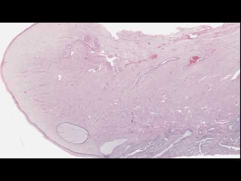 Histology of the Cervix