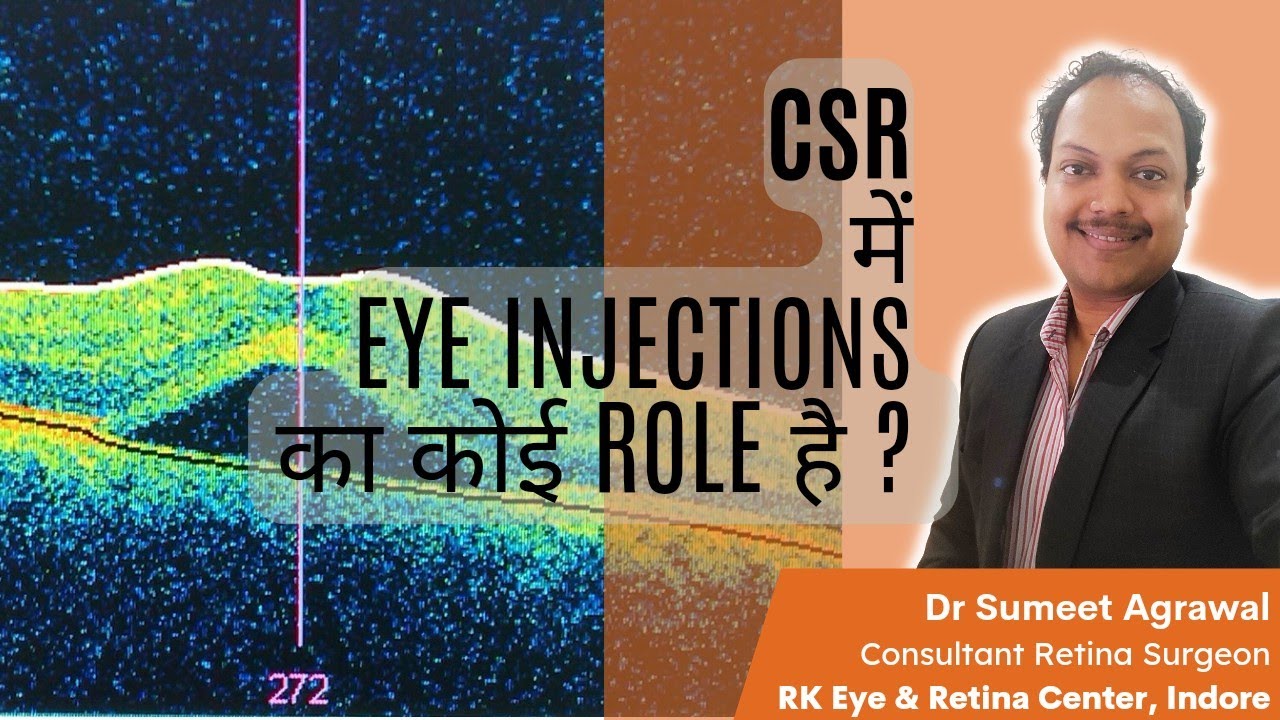 CSR में Eye Injections ? क्या लगाना चाहिए ? - YouTube