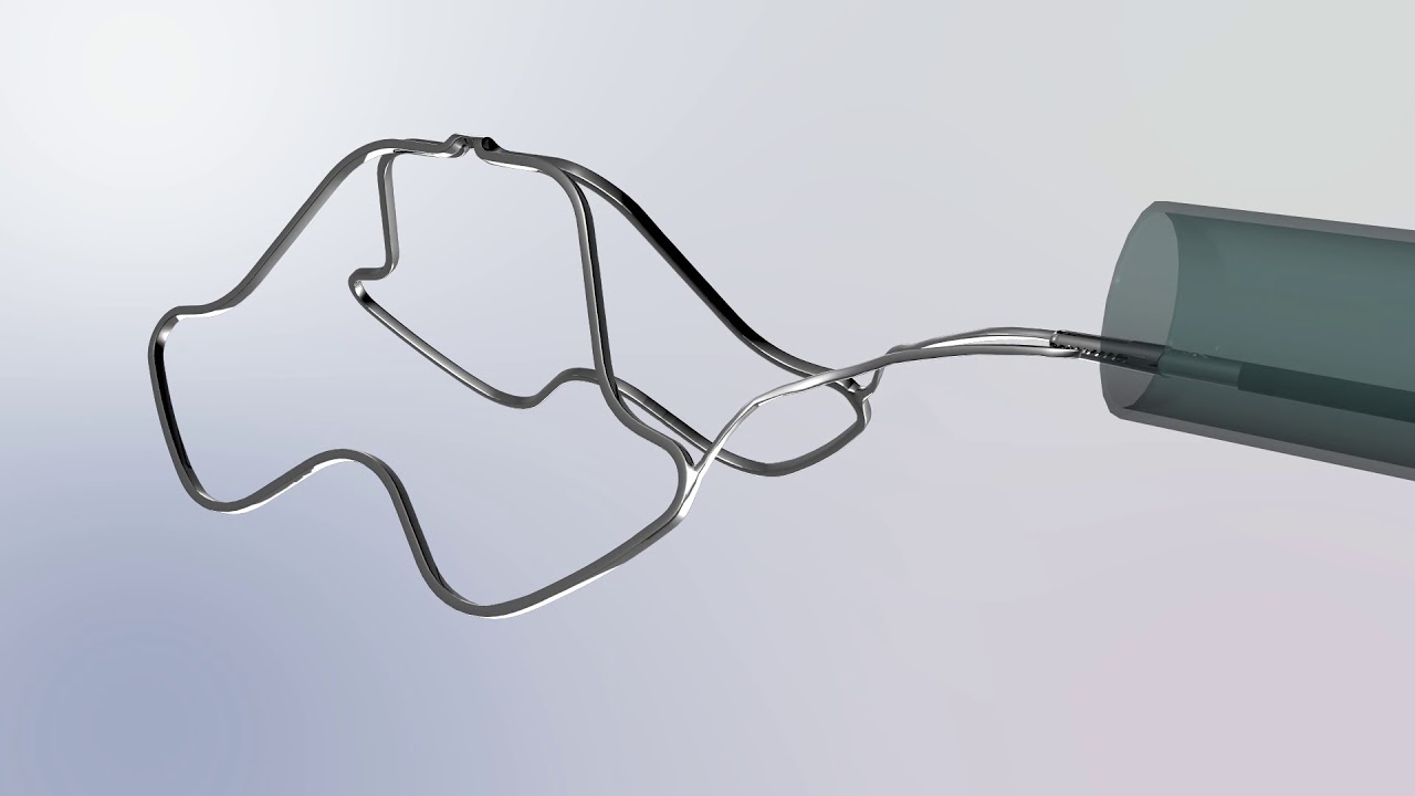 Extraction Illustration - YouTube